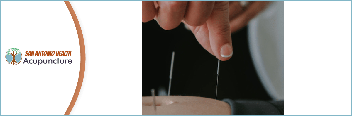 Gallery - San Antonio Health Acupuncture